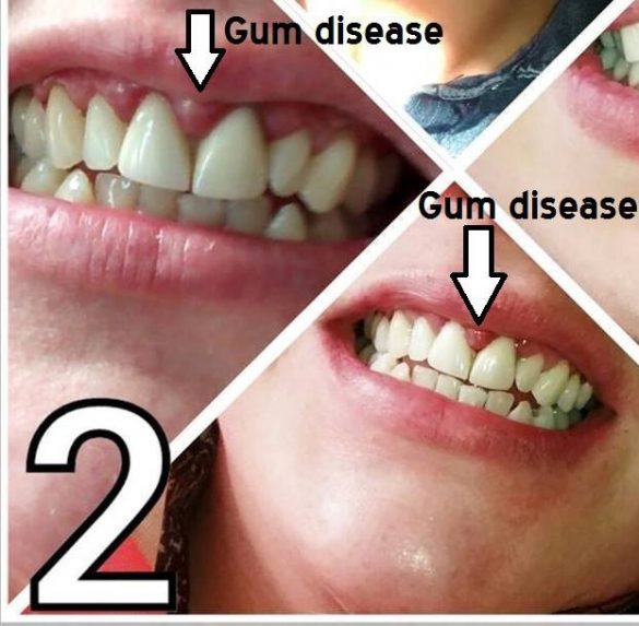 Public warned of dangers of illegal tooth whitening practices – Derry Daily Public warned of dangers of illegal tooth whitening practices – Derry Daily